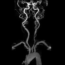 Angiography – Corvallis Radiology PC