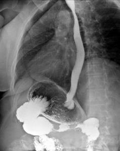 Fluoroscopy – Corvallis Radiology PC